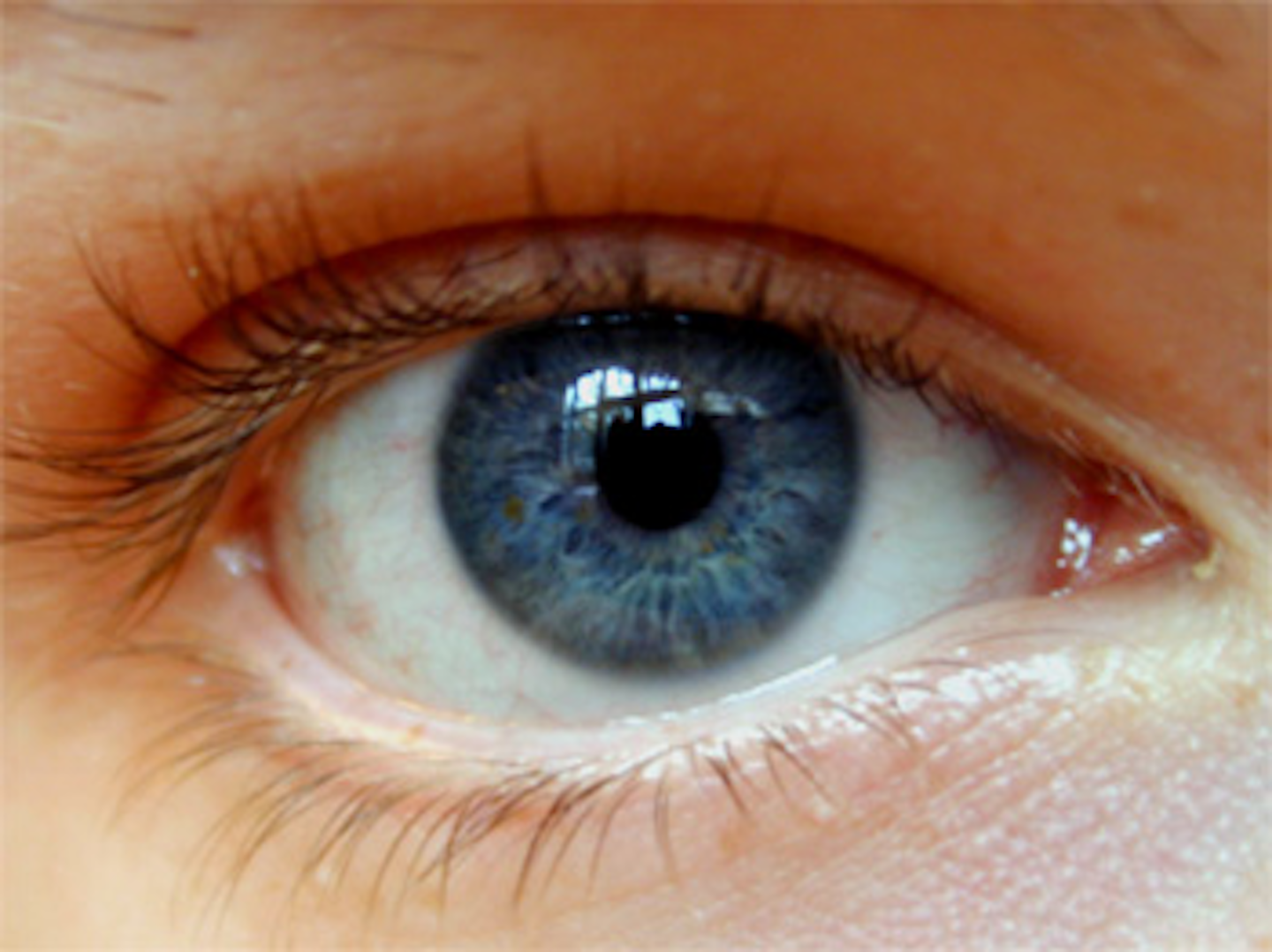 Images of the eye linked to heart disease | Vision Systems Design