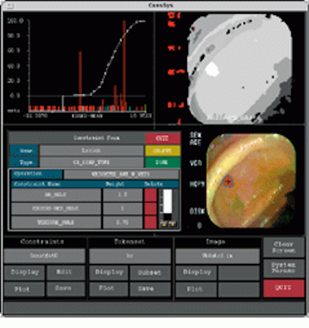 Pattern Recognition Systems Use To Add Intelligence Vision Systems Design