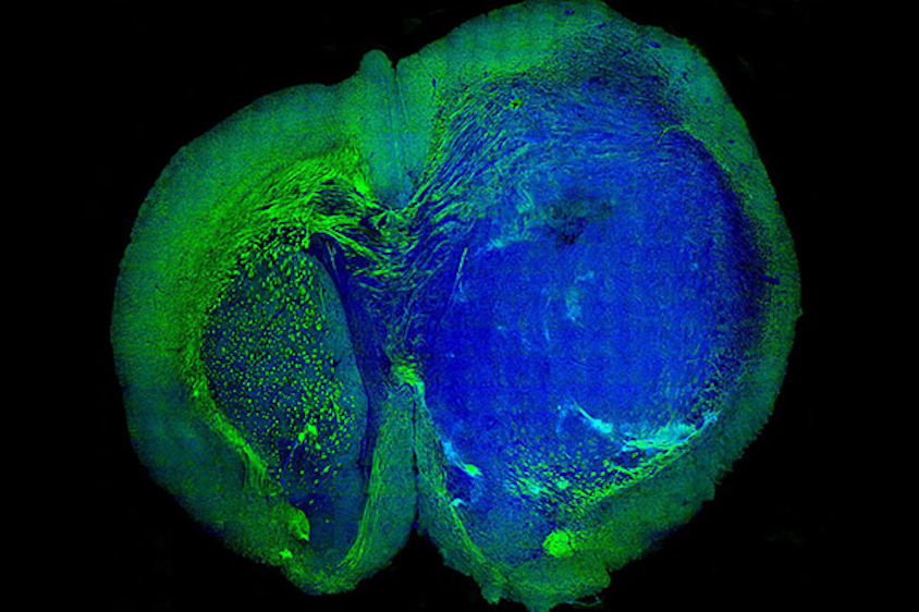 Five examples of innovative medical imaging techniques | Vision Systems ...