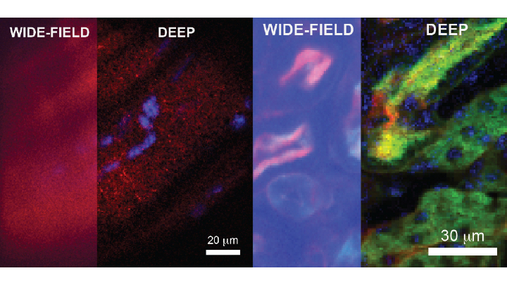 Computational and NIR imaging increase wide-field microscopy depth and resolution at increased ...